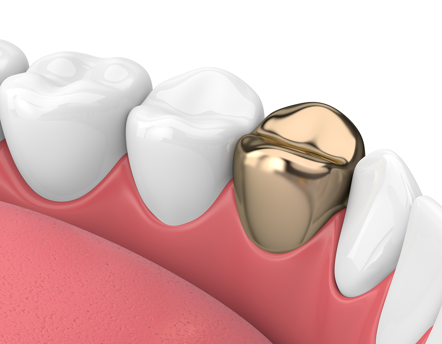 Same Day Dentistry and Traditional Dental Care